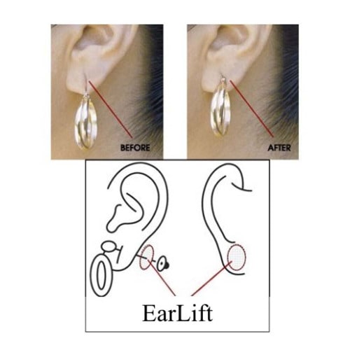 EarLift Invisible Ear Lobe Support Solution-60 Patches | 3599826 ...