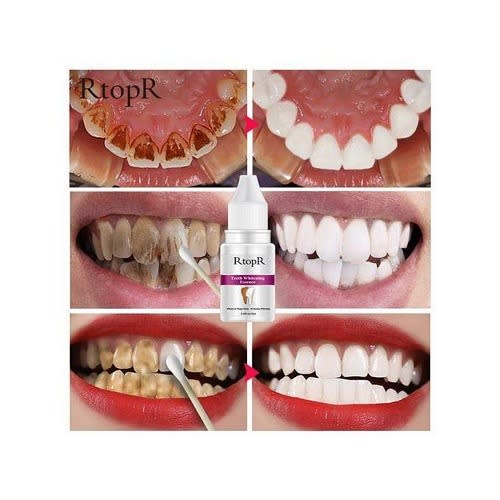 Rtopr Teeth Whitening - 10ml | Konga Online Shopping