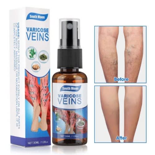 South Moon Varicose Veins Spray Treatment - 30ml | 6184229 | Konga ...