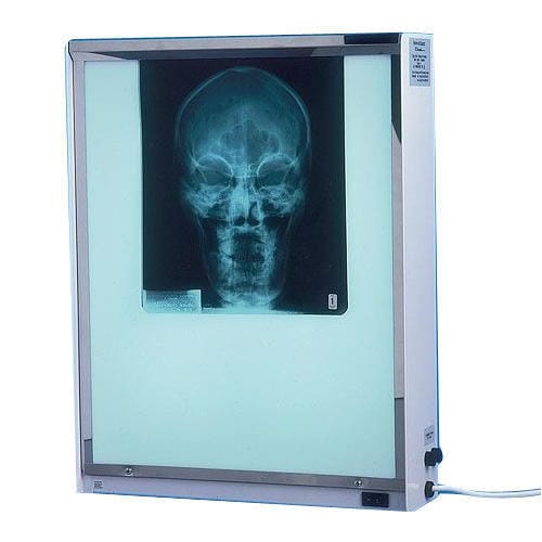 Xray Viewing Box (single) | 3961430 | Konga Online Shopping
