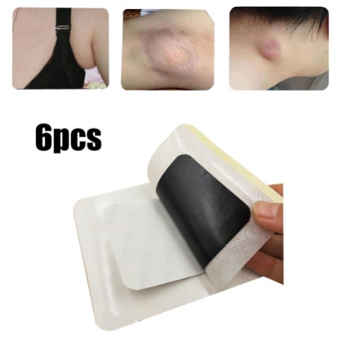 Lymphatic Detox Patch Anti-swelling Herbal Stickers Pain Relief - 6pcs ...