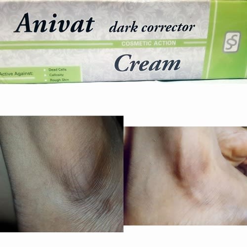 Dark Corrector Cream | Konga Online Shopping Dark Corrector Cream | Konga Online Shopping